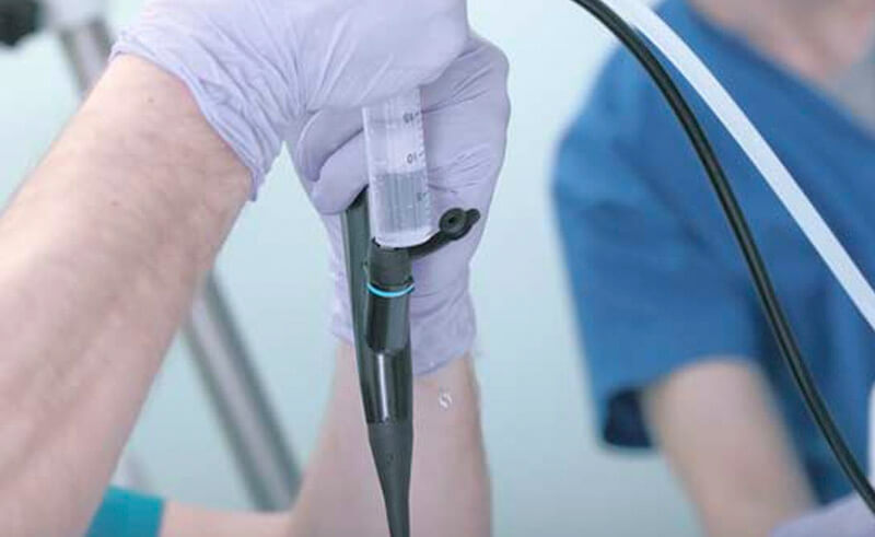 Cystoscopy - Gynecology Services Cherry Hills Village, CO | Health ...