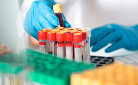 Biote® Hormone Pellet Therapy - Gynecology Services Littleton, CO ...